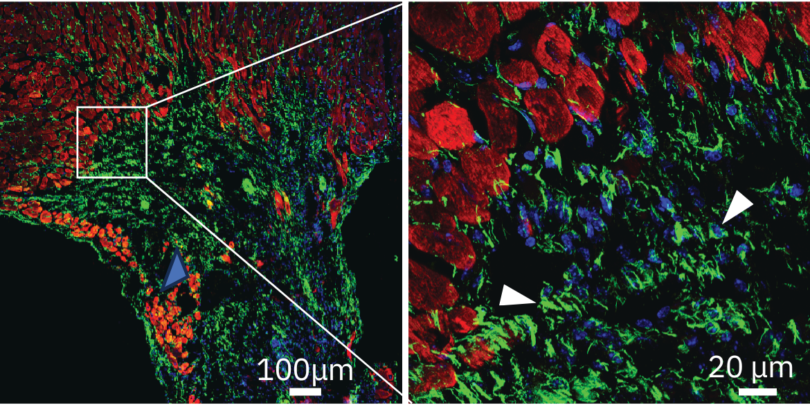 UCLA researchers engineer experimental drug for preventing heart ...