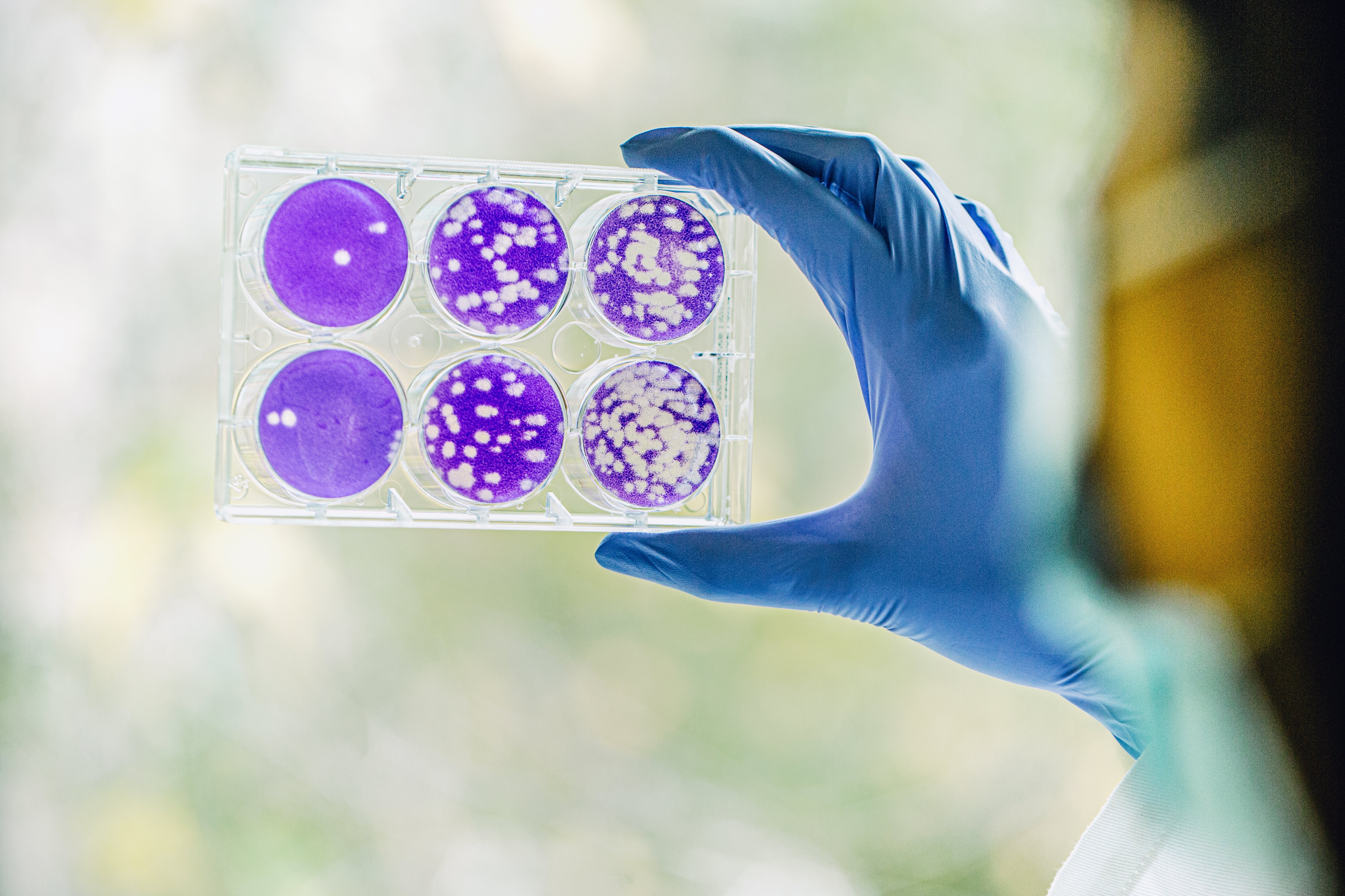 Understanding Stem Cell Research | UCLA BSCRC