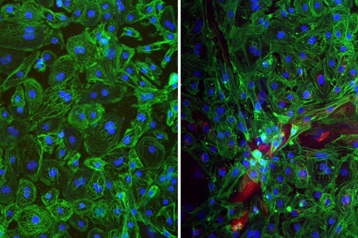 UCLA scientists use mini organ models to uncover secrets of deadly ...
