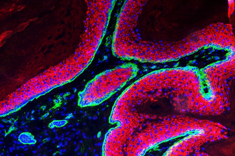 Four UCLA stem cell researchers awarded $12 million in grants to ...