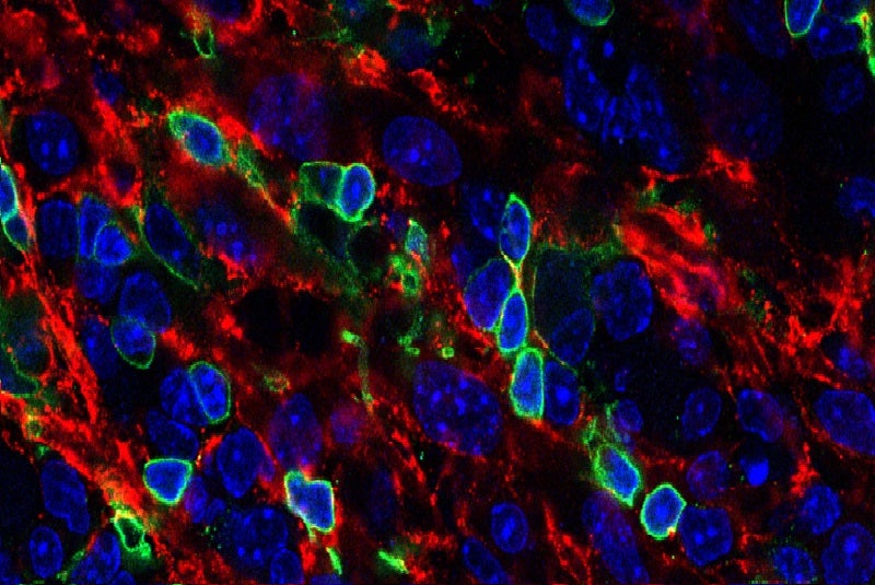 UCLA researchers create millions of diverse T cells from a single blood ...