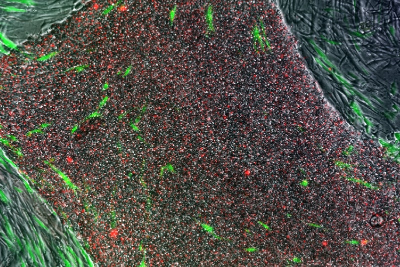 UCLA issued patent for method that helps stem cell scientists find ‘a ...