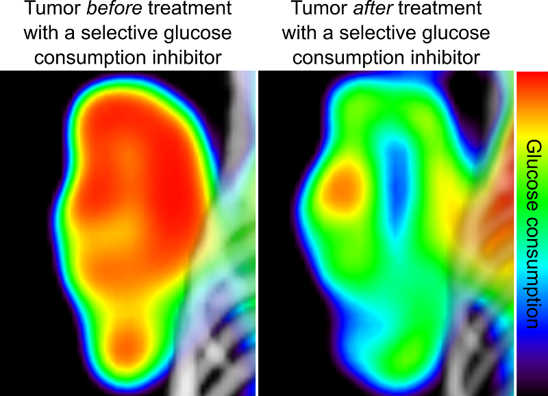 Automated technique helps identify cancer cell metabolism inhibitors