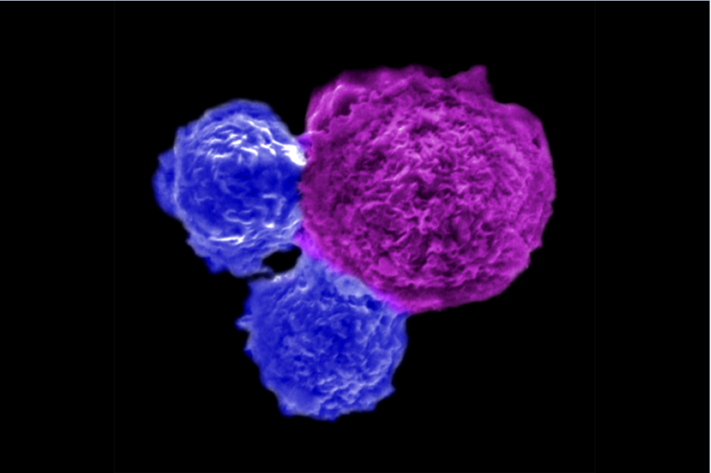 Cell therapy could improve bone marrow transplant safety